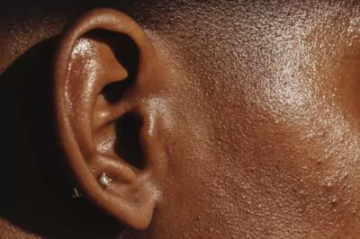 Best Ways To Improve Skin’s Texture: 7 Tips for Smoother Skin ...