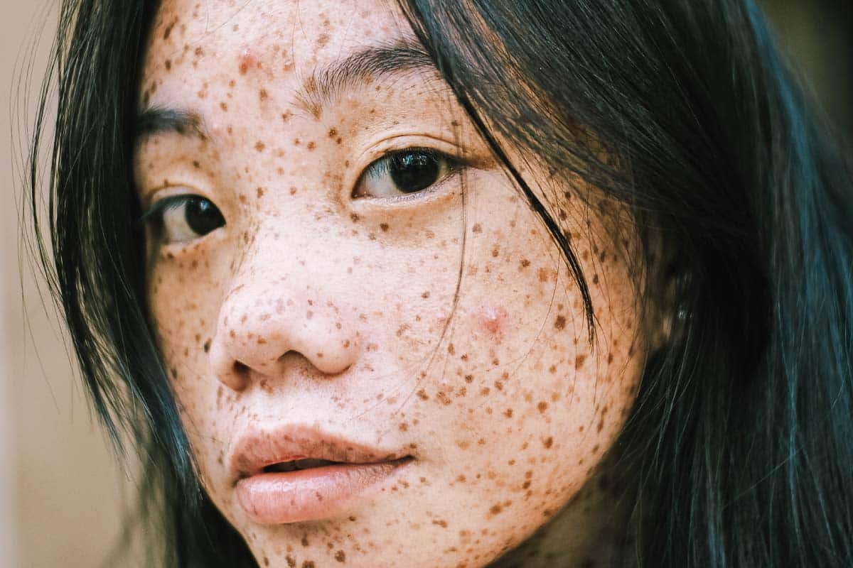 Best Ways To Improve Skin’s Texture: 7 Tips for Smoother Skin ...